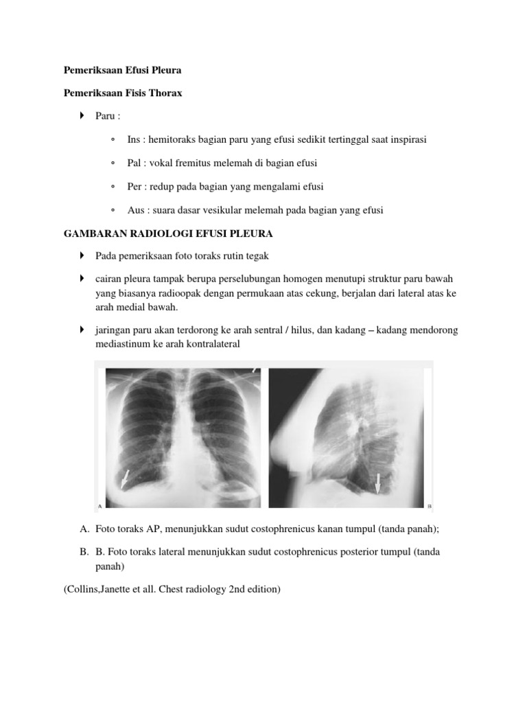 Pemeriksaan Efusi Pleura | PDF