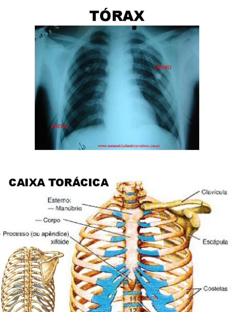 Radiografia do Tórax: Incidências, Posicionamentos e Anatomia | PDF ...