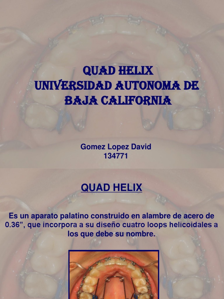 Activación y Tipos de Quad Helix | PDF | Ciencia y matemáticas | Tecnología