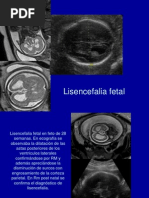 Obstrucción y Estasis Urinaria | PDF | Vejiga urinaria | Urología