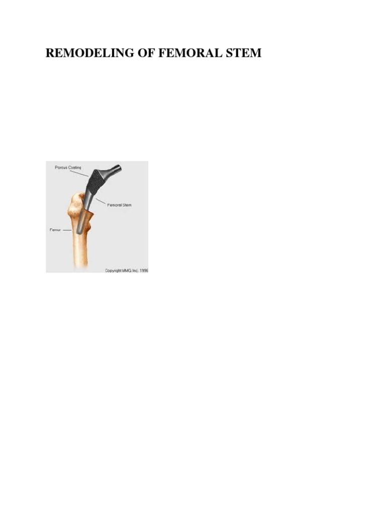 Femoral Stem Design and Remodeling Insights | PDF | Dental Implant | Hip