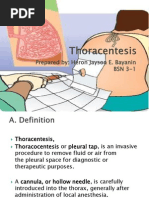 Pleural Fluid Tapping Procedure Guide | PDF | Respiratory System ...