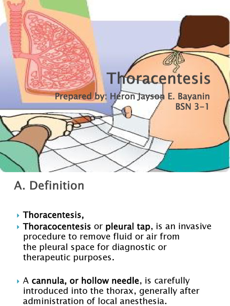 Thoracentesis | Diseases And Disorders | Health Sciences