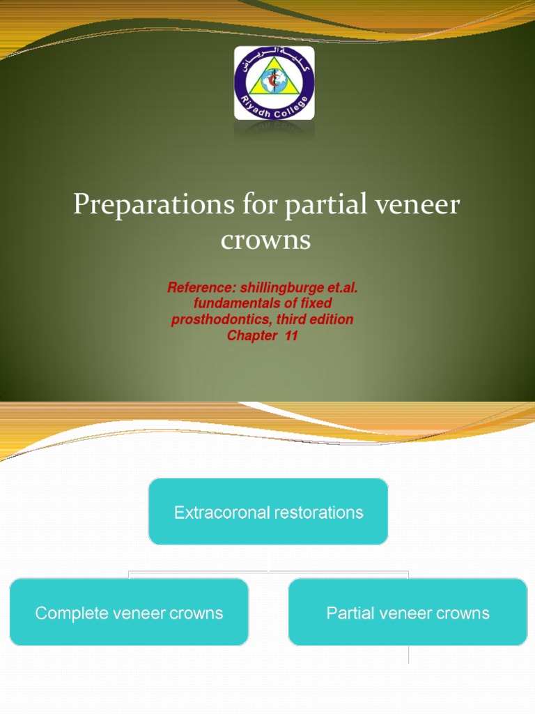 Preparing Tooth Surfaces for Partial Veneer Crowns: Reduction ...