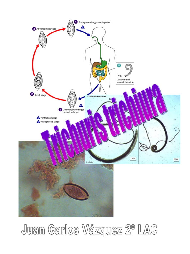 Trichuris Trichiura | PDF | Bienestar | Medicina