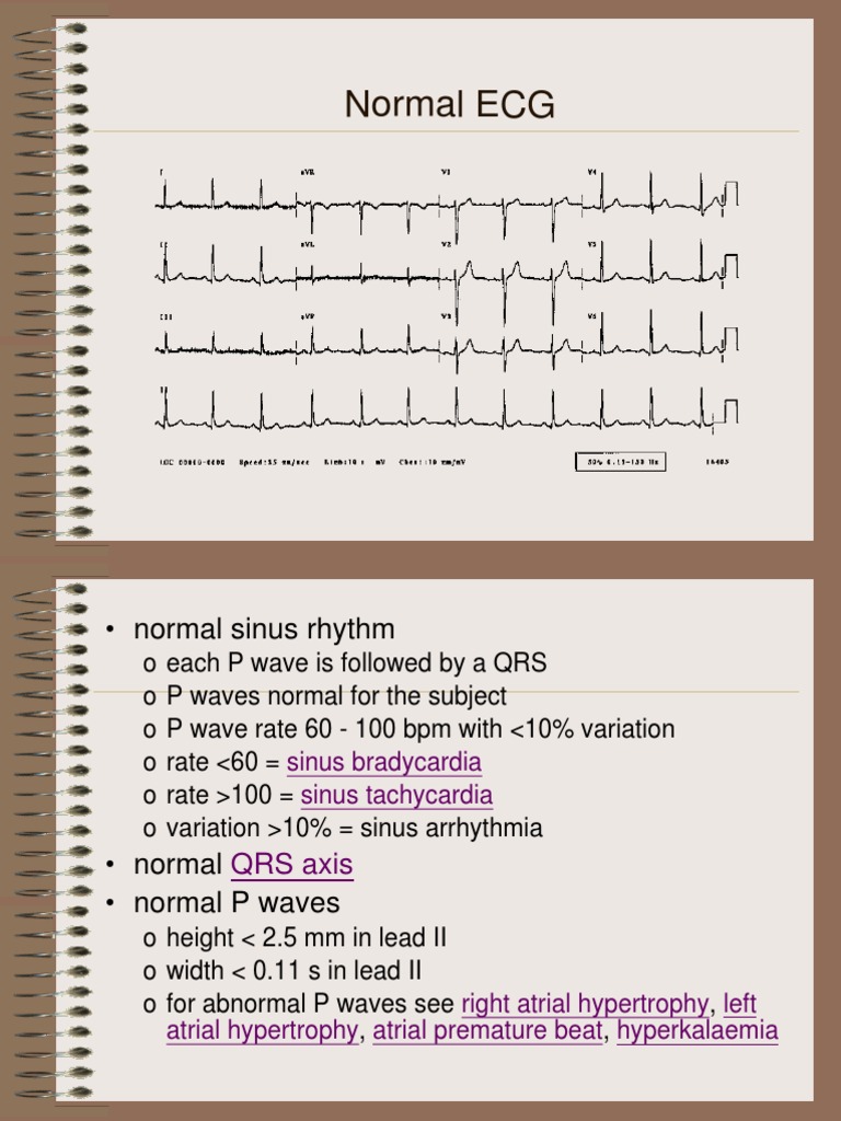 ECG Interpretation and Heart Conditions | PDF | Art | Wellness