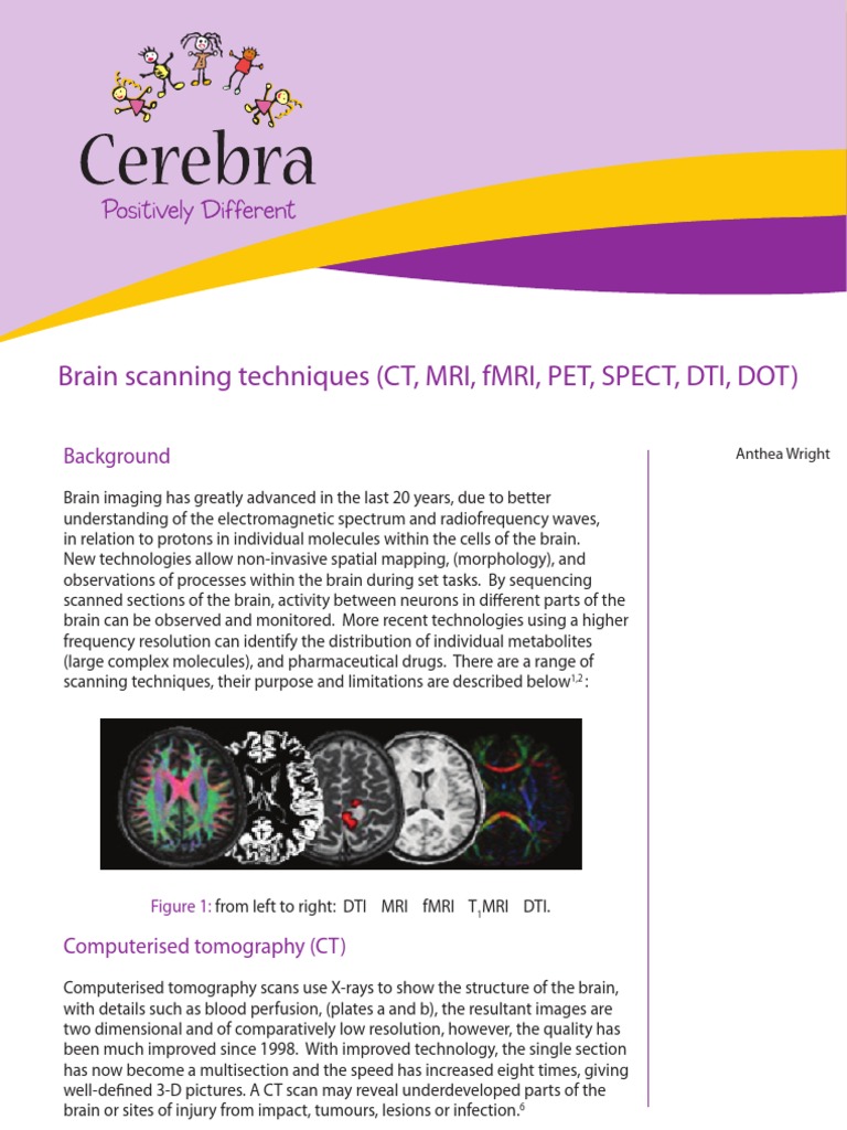 Brain Scanning Techniques | PDF | Positron Emission Tomography | Gamma Ray
