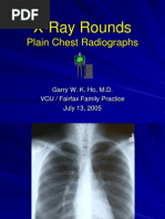 Chest X-Ray Template | PDF | Lung | Thorax