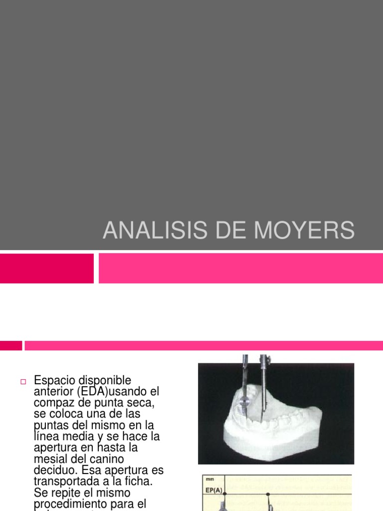 Analisis de Moyers | PDF