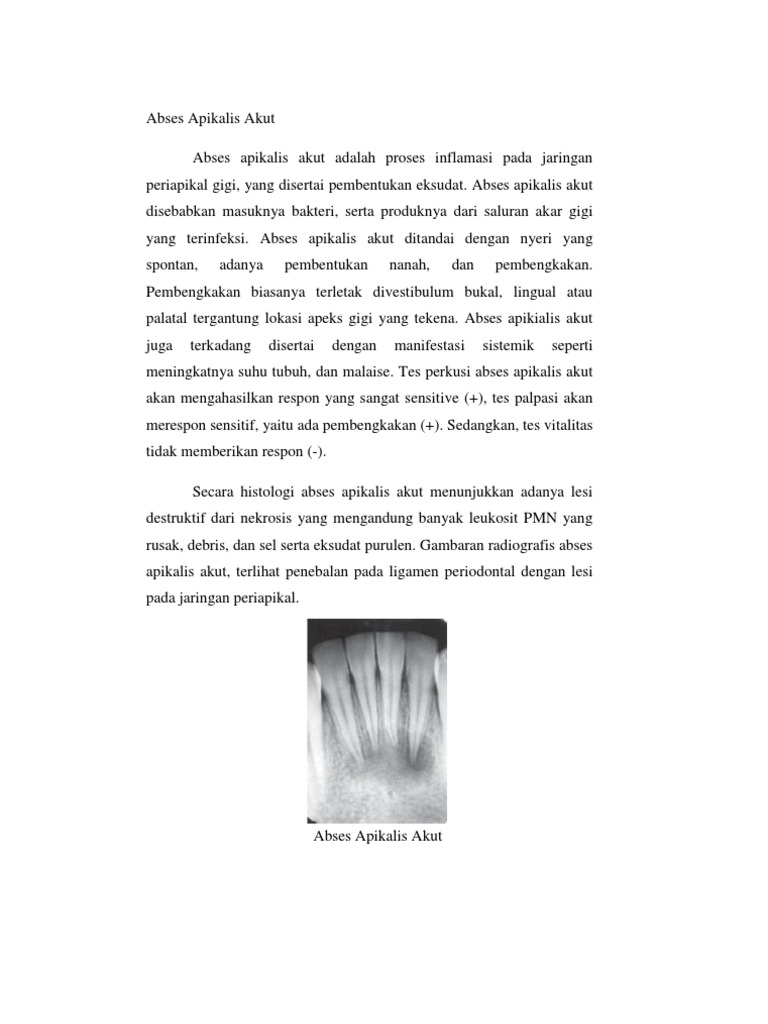 Abses Apikalis Akut | PDF