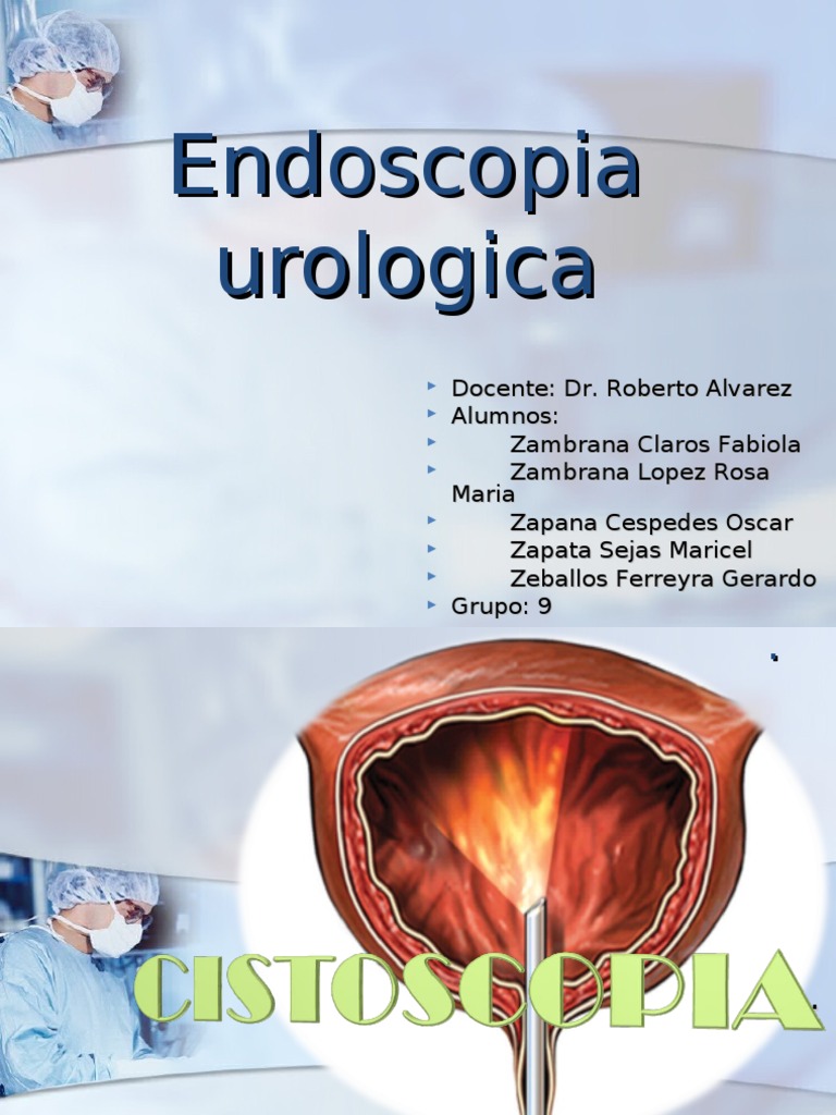 Endoscopia Urologica GROUP 2 | Vejiga urinaria | Órgano (Anatomía)