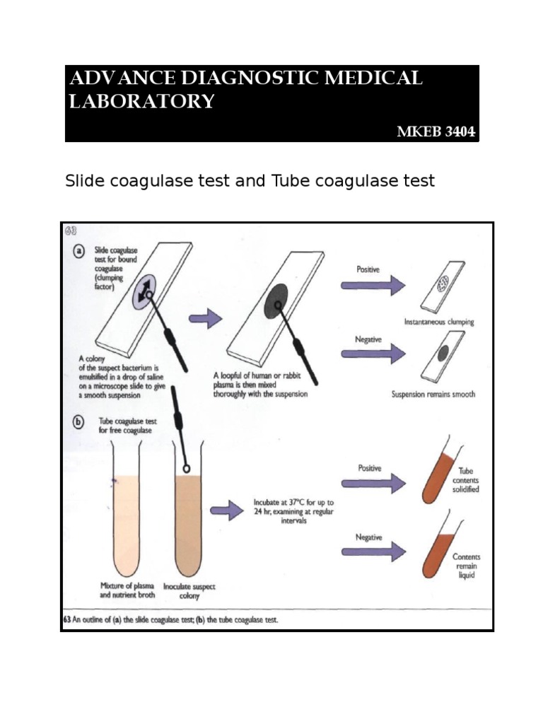 Slide Coagulase Test and Tube Coagulase Test | PDF