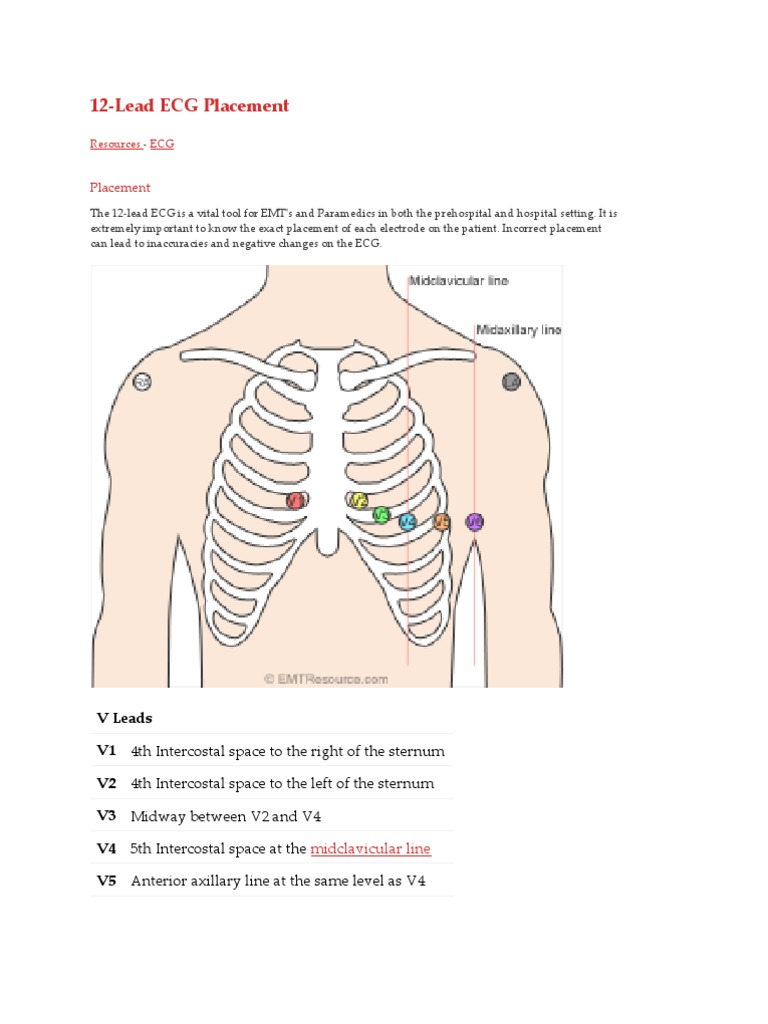 ECG Placement | PDF
