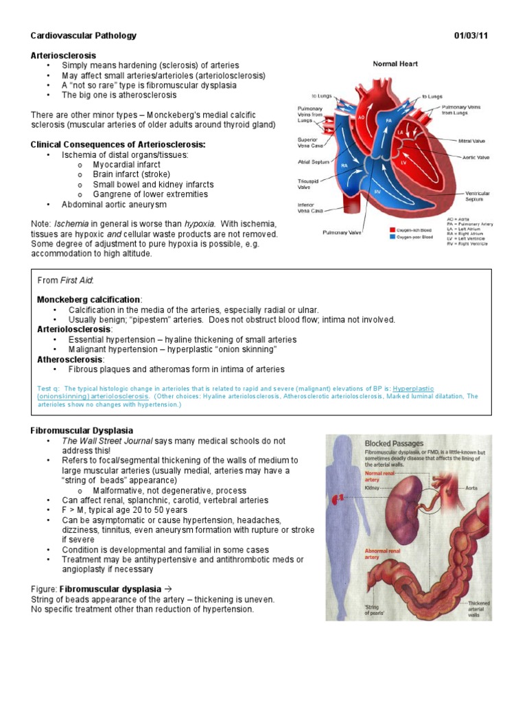 Cardiovascular Pathology | Atherosclerosis | Atheroma