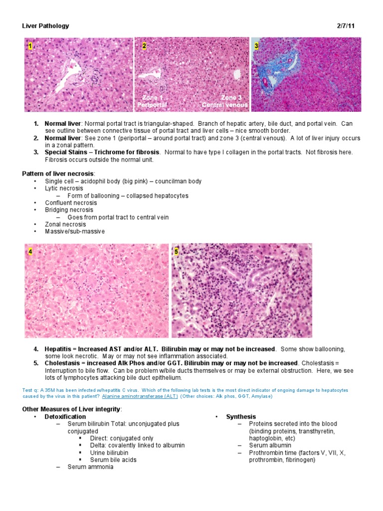 Liver Pathology | PDF | Hepatitis | Cirrhosis