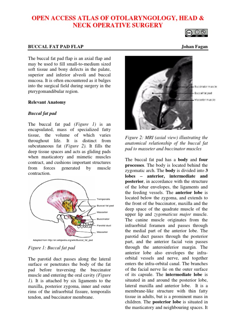 Buccal Fat Pad Review PDF | PDF | Anatomical Terms Of Location | Anatomy