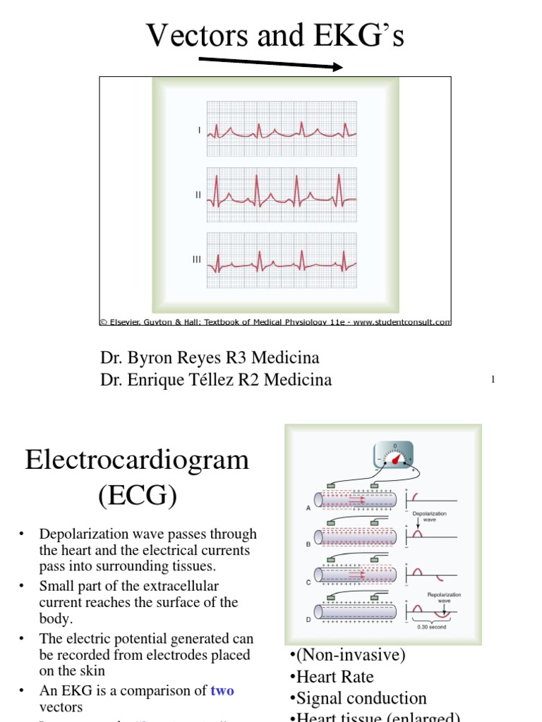 16 Analyzing EKG Vectors and MEA | PDF | Electrocardiography | Atrium ...