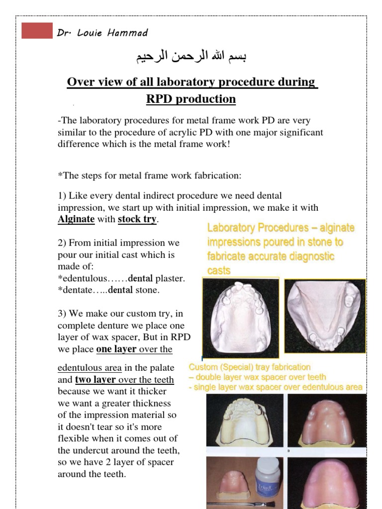 Over View of All Laboratory Procedure During RPD Production: Alginate ...
