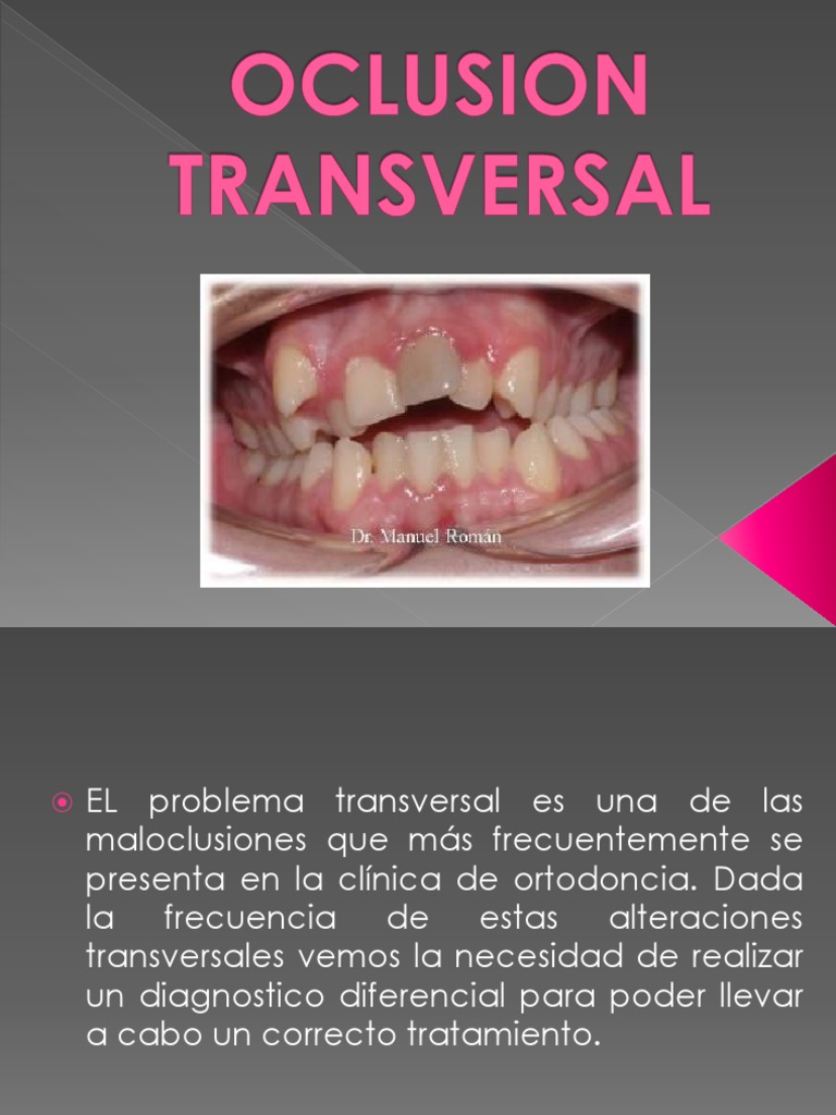 Oclusion Transversal | PDF | Diente humano | Ramas de Odontología