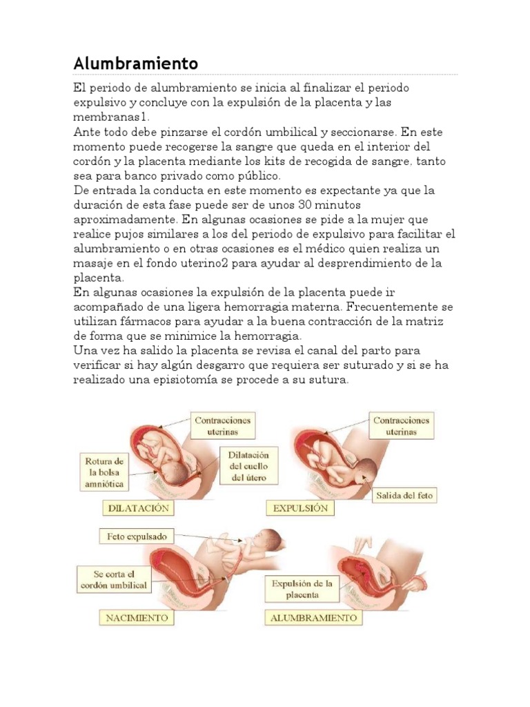 Fases del Parto y Cesárea: Guía Completa | PDF | Placenta | Parto