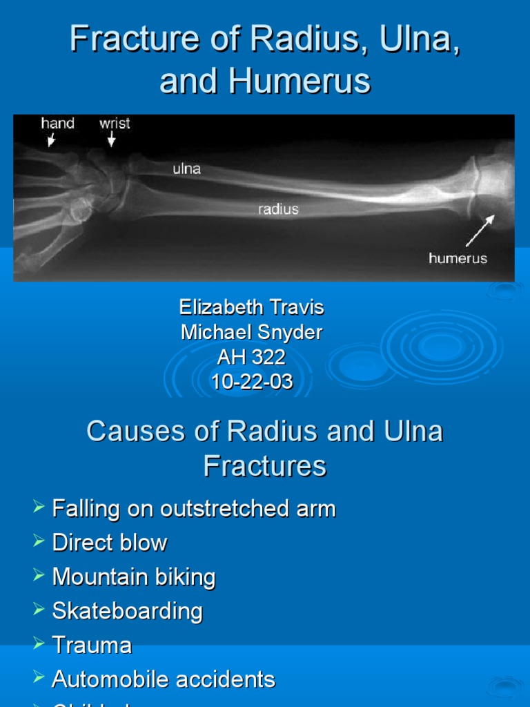 Causes and Types of Arm Fractures | PDF | Musculoskeletal Disorders ...