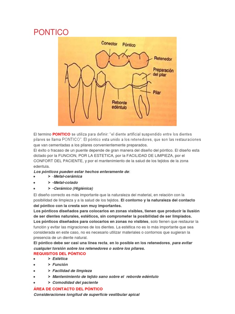 PONTICOS | PDF | Diente humano | Dentadura postiza
