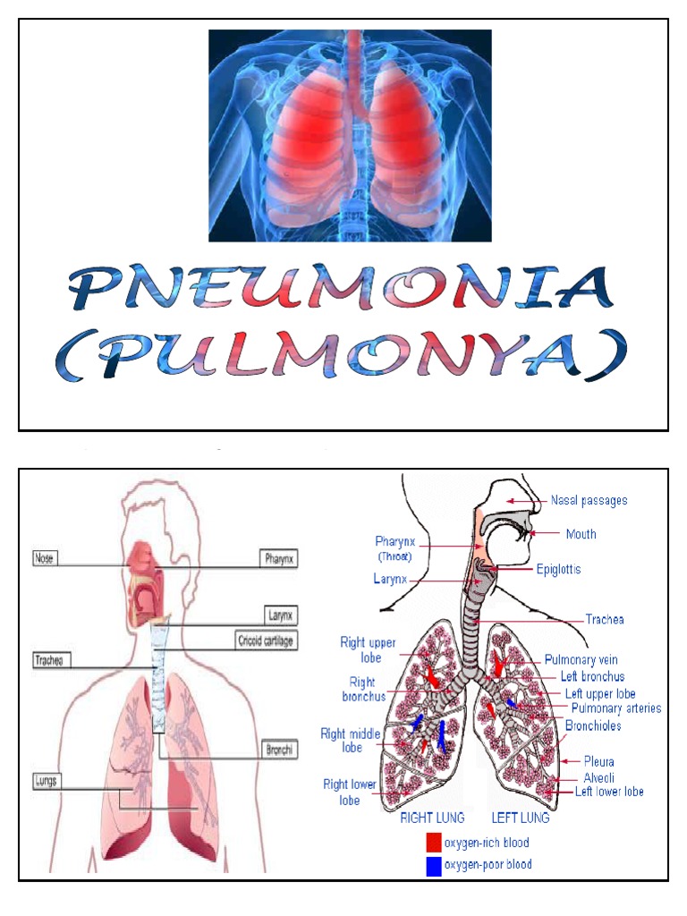 Pulmonya | PDF