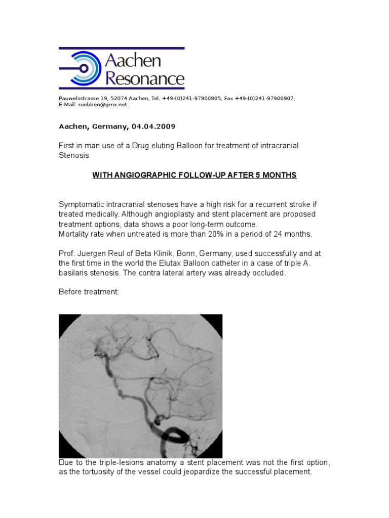Elutax Intracranial Control | PDF | Clinical Medicine | Cardiovascular ...