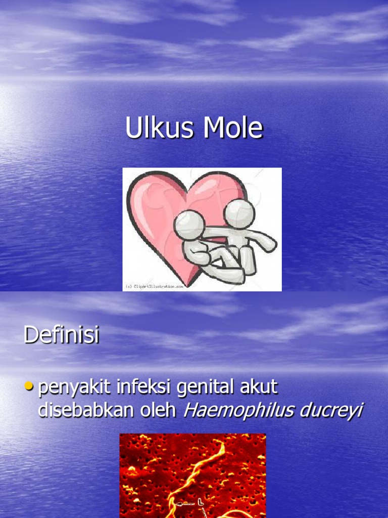 Ulkus Mole | PDF