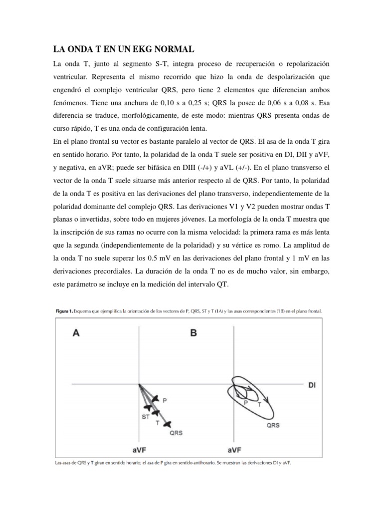 La Onda T en Un Ekg Normal | PDF | Electrocardiografia | Imagenes medicas