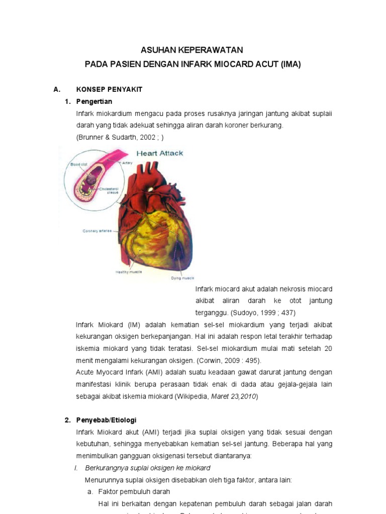 Infark Miokard | PDF