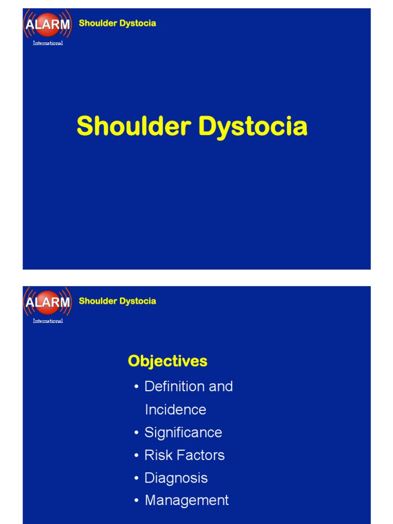 Shoulder Dystocia Guide | PDF | Arm | Childbirth