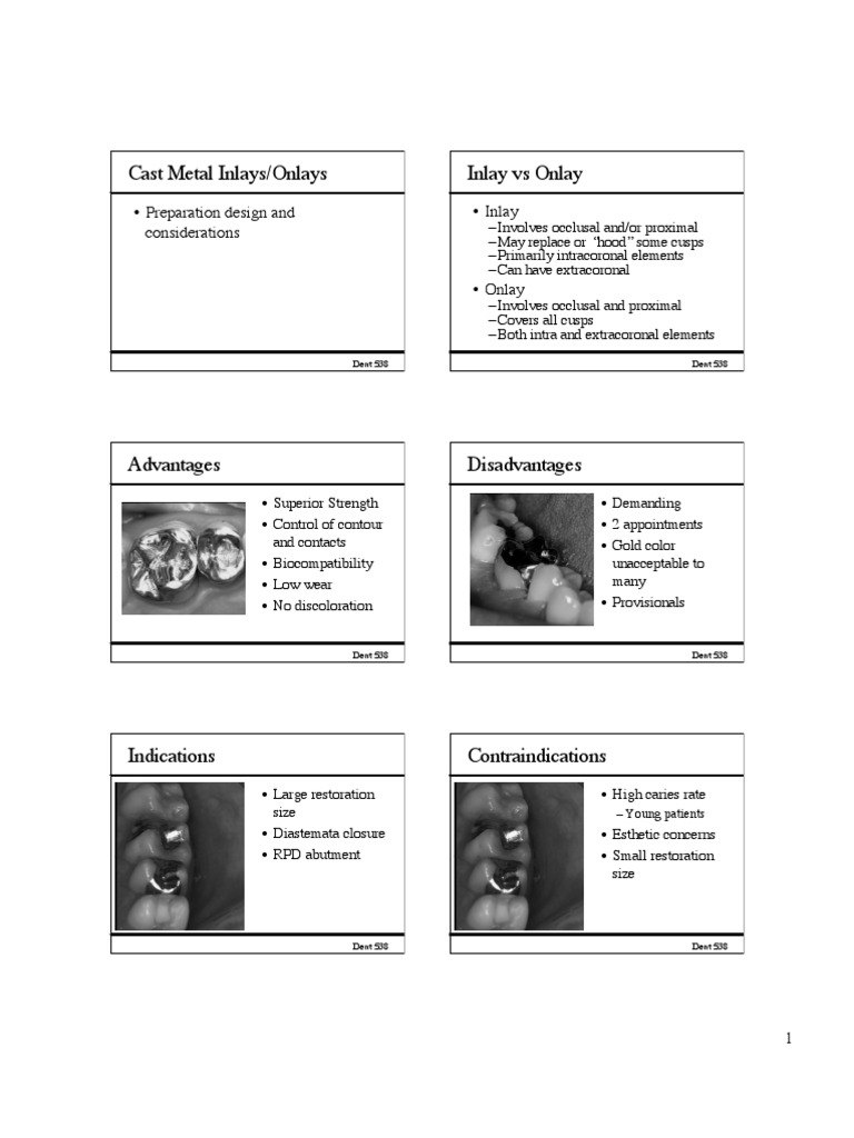 Cast Metal Inlays - Onlays | PDF | Mouth | Dentistry Branches