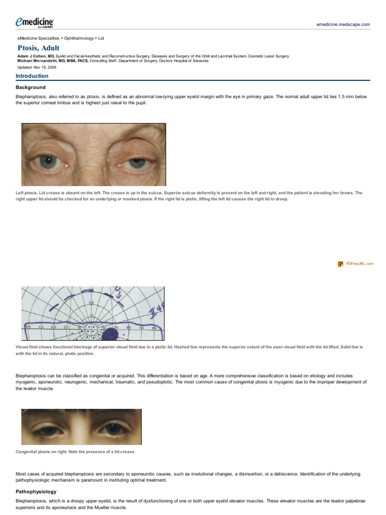 Ptosis, Adult: Background
