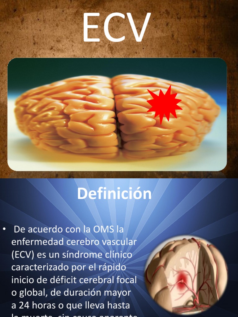 ECV | PDF | Isquemia | Angiología