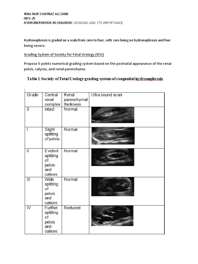 Hydronephrosis GRADING | PDF | Surgical Specialties | Organ (Anatomy)