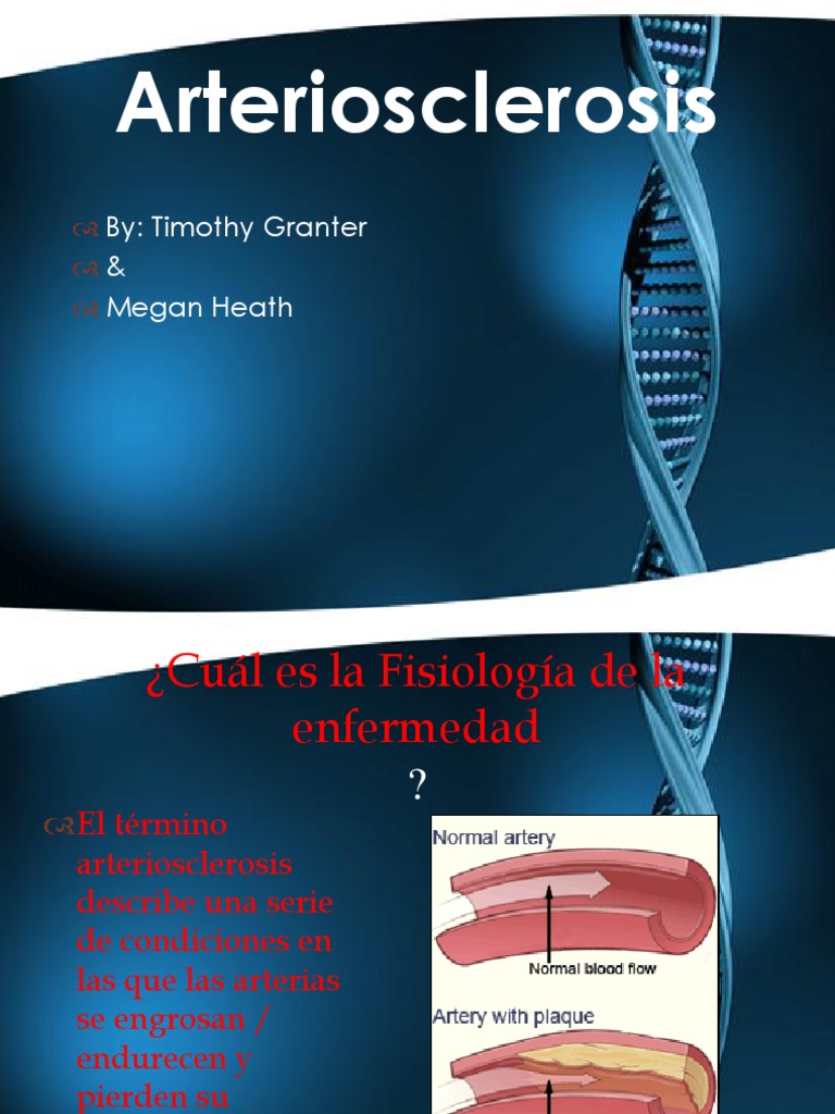 Arteriosclerosis | PDF