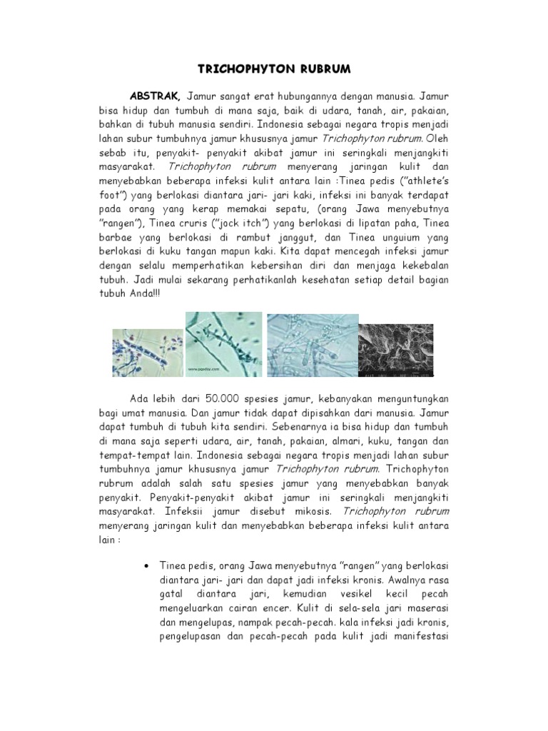 Trichophyton Rubrum | PDF