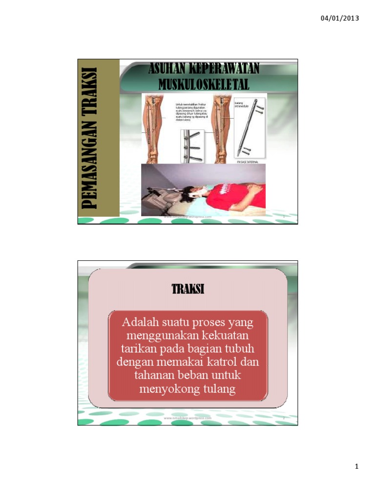 Pemasangan dan Perawatan Traksi Kaki | PDF