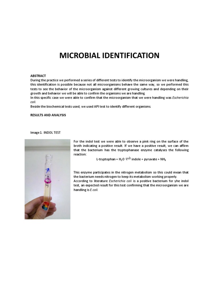 Informe6 Microbiologia | PDF | Fermentation | Urea