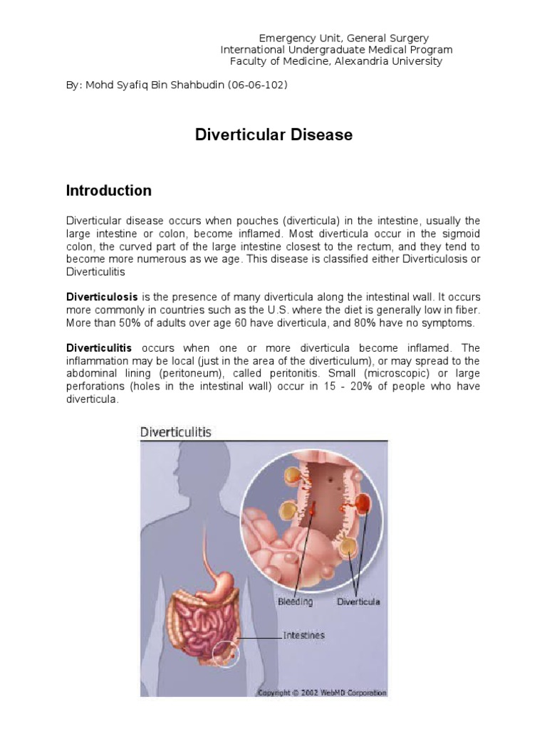 Diverticulosis | Colonoscopy | Gastroenterology