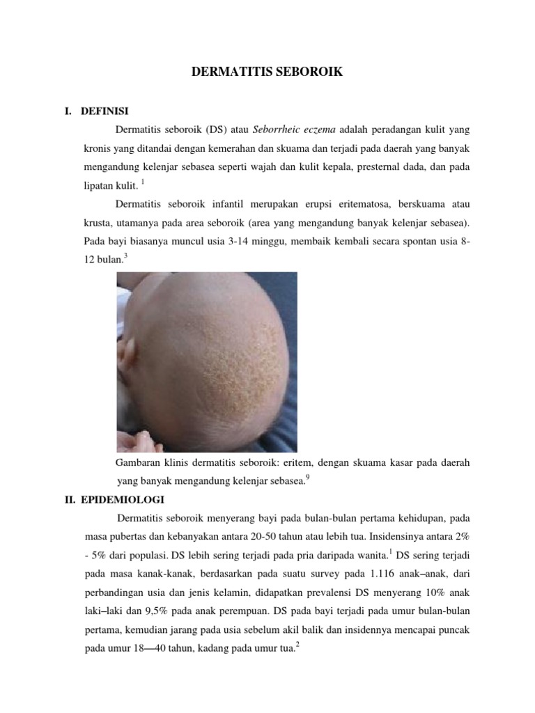 Dermatitis Seboroik | PDF