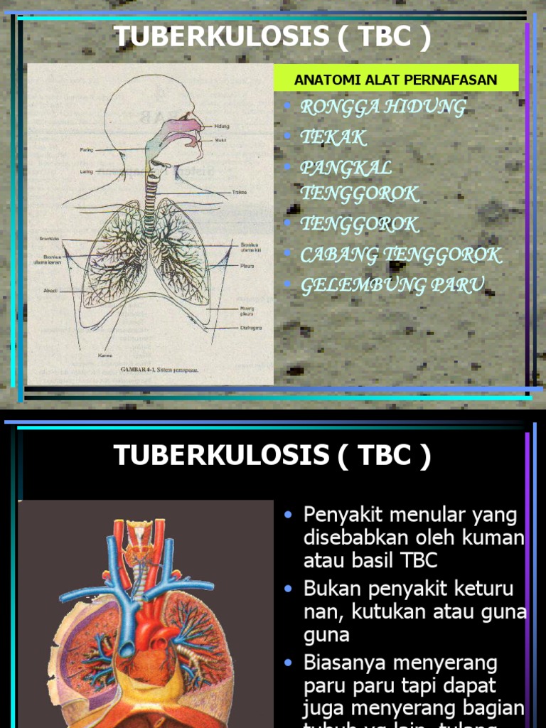 TB PARU