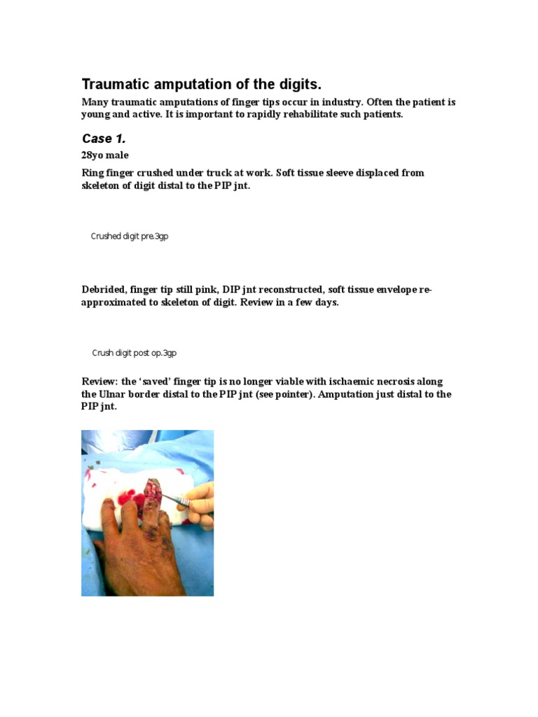 Crushed Finger Surgery-Take You Time They Do Well | PDF | Science ...