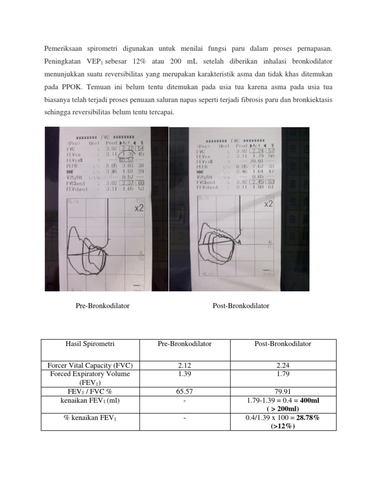 Pemeriksaan Spirometri | PDF