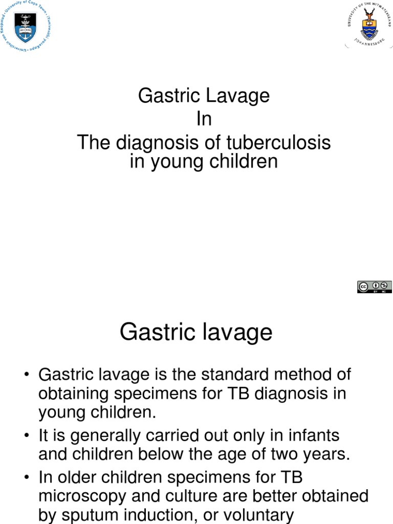 Gastric Lavage PPT | Saline (Medicine) | Tuberculosis