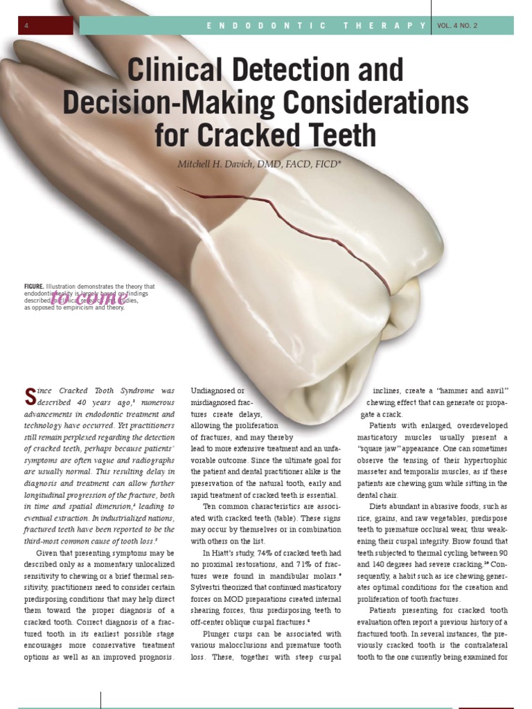 Clinical Detection of Cracked Teeth | PDF | Mouth | Dentistry Branches