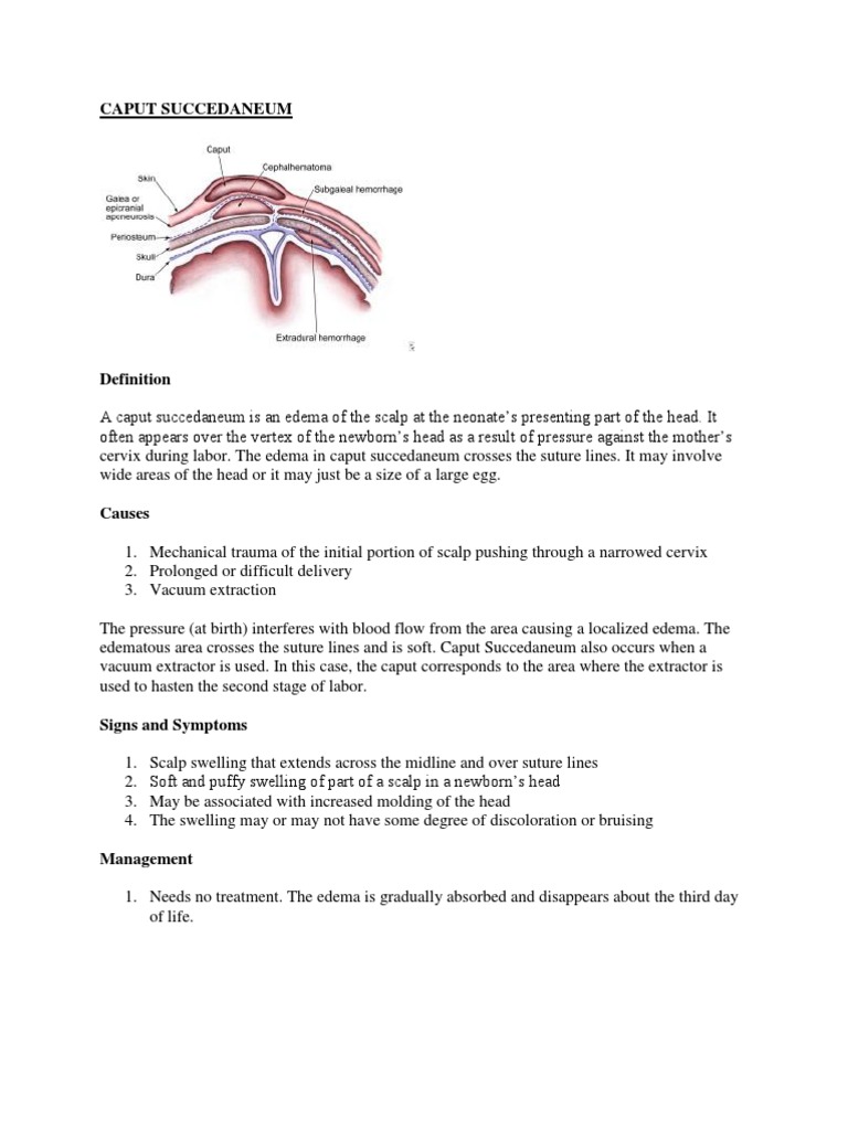 Caput Succedaneum | PDF | Edema | Bone
