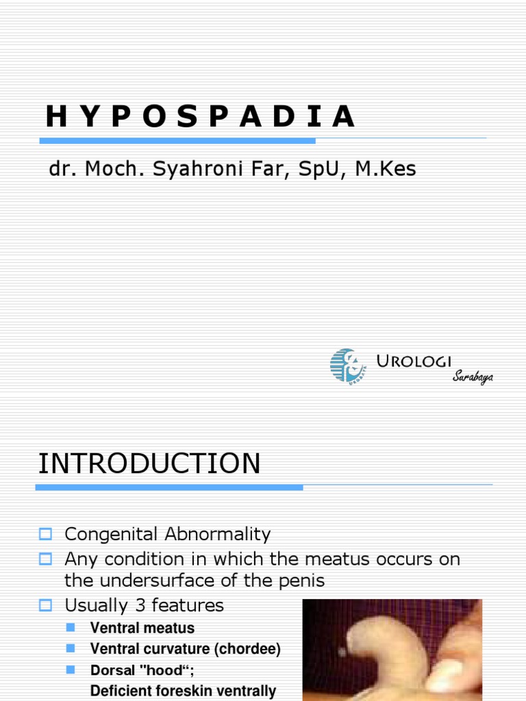 Hypospadia | Surgical Specialties (90 views)
