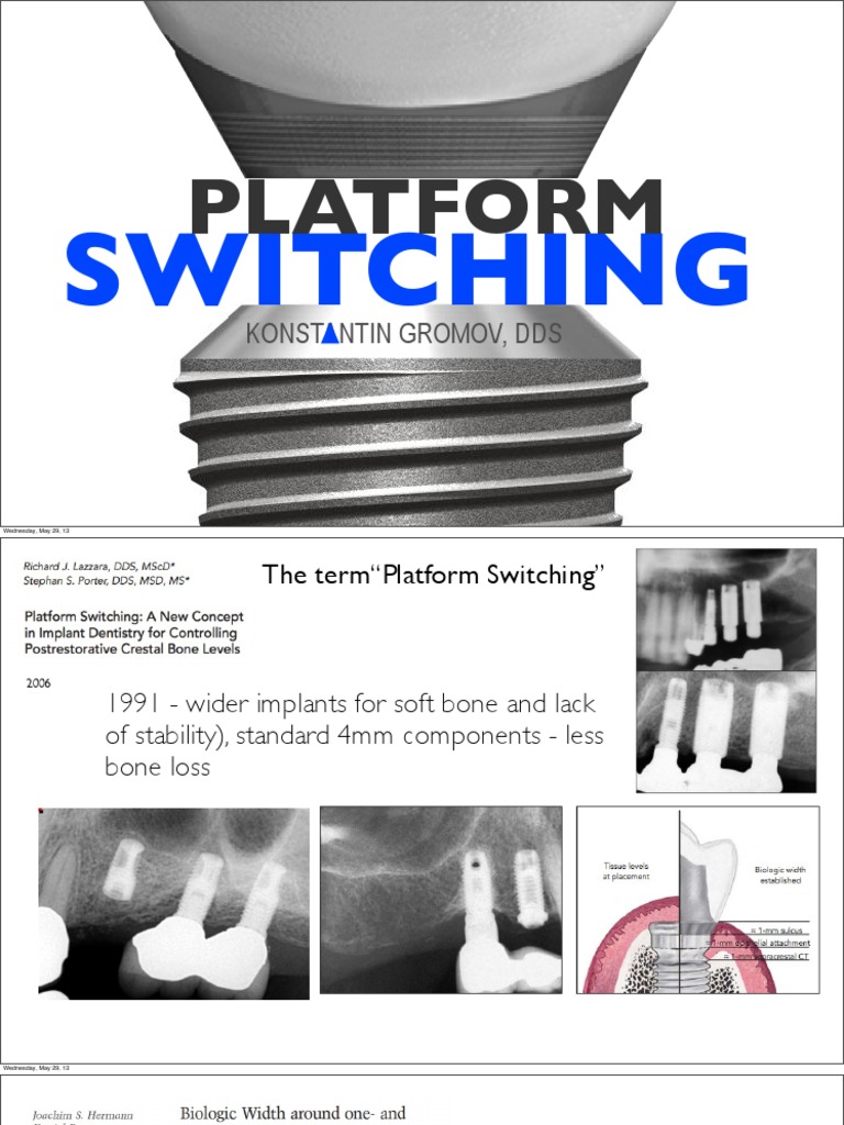 Platform Switching, Gromov | PDF | Dental Implant | Health Sciences